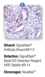 Immunohistochemistry Troubleshooting: Steps 2, 3, and 4.