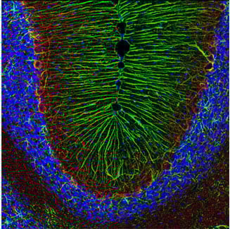 Guide to Neuronal & Glial Cell Markers | CST Blog