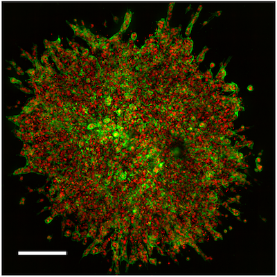 High-Throughput 3D Assays: Analysis of TGF-β Signaling