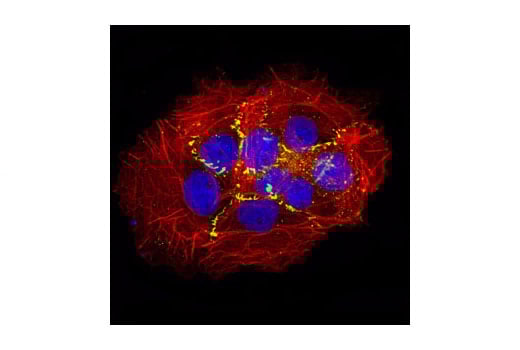 5 Tips for Great Immunofluorescence Cell Staining