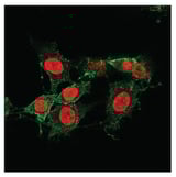 Mechanisms of Cell Death: Necrosis & Necroptosis | CST Blog