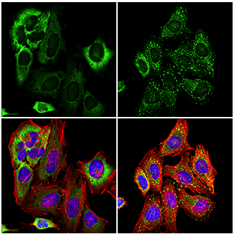 What Are Stress Granules? Key Markers for Neurodegeneration Research