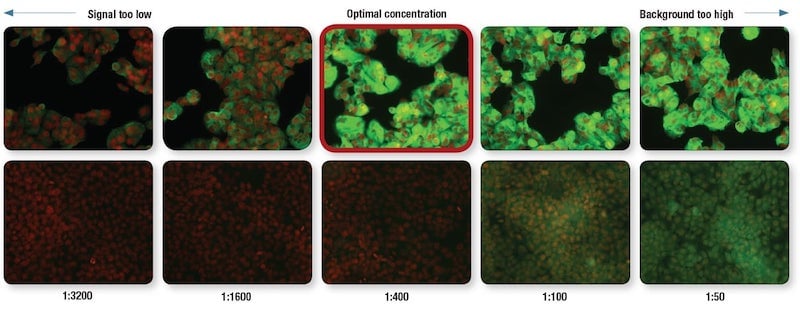 Immunofluorescence: Antibody Dilution and Incubation Conditions