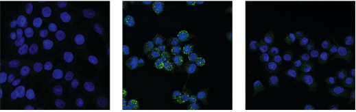 Necroptosis & Pyroptosis: Understanding Apoptotic Cell Death