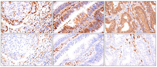 Targeting the YAP/TAZ-TEAD Signaling Pathway in Cancer Research