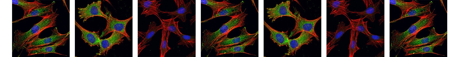 What to Ask Before Starting Your Next Immunofluorescence Experiment