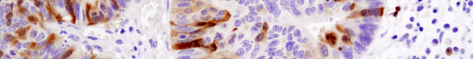 Immunohistochemistry Troubleshooting: Steps 2, 3, and 4.