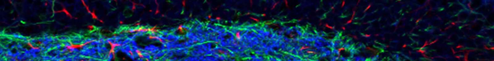 Fluorescent Staining Using Multiple Antibodies