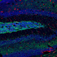 Multiplexing Methods: IF Staining Using Multiple mAbs | CST Blog
