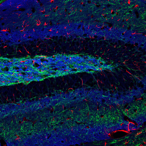 Immunofluorescent Staining Using Multiple Antibodies