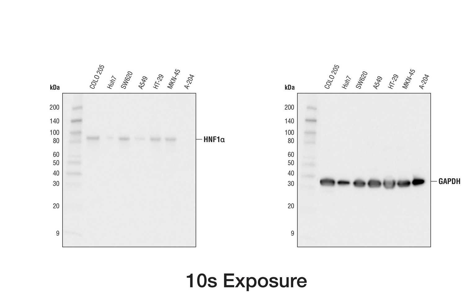 Western Blot Normalization: Are my loading controls set up correctly?