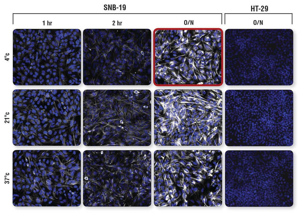 Successful Immunofluorescence: Antibody Dilution and Incubation Conditions