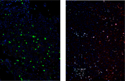 Demystifying Antibody Panel Design for Multiplex IHC