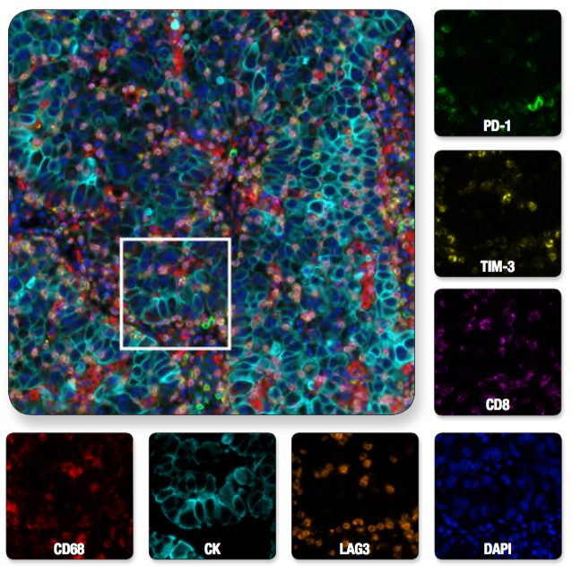 Antibody Panel Design for Multiplex IHC of the Tumor Microenvironment
