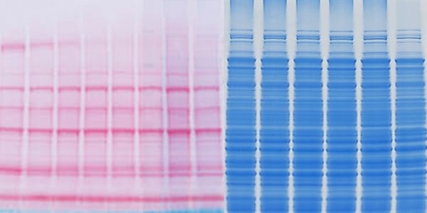 Western Blot Troubleshooting: Ponceau S vs Coomassie Blue Staining
