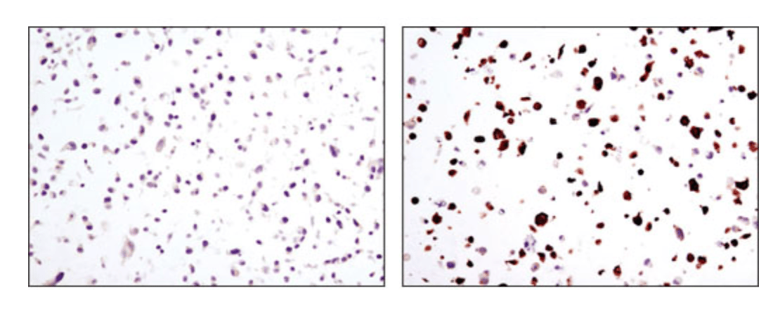 Epitope Tagging & Antibody Selection | Myc-Tag