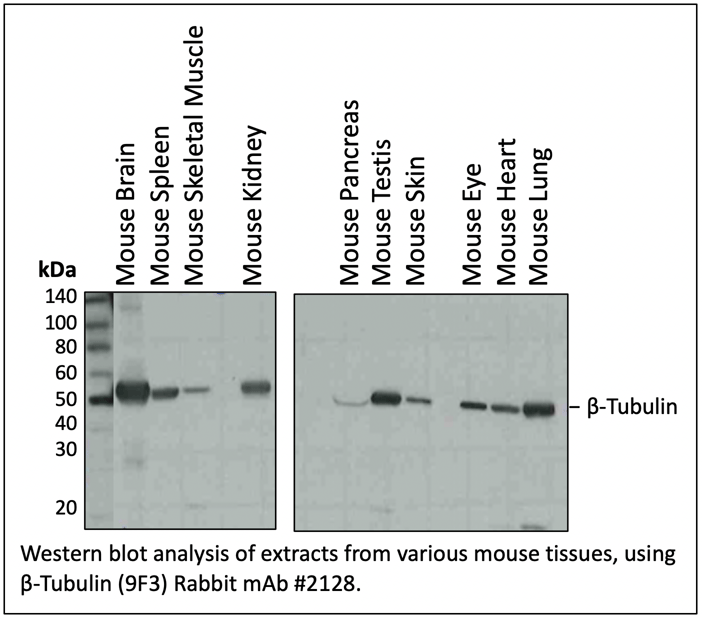 Mouse Tissue Loading Controls