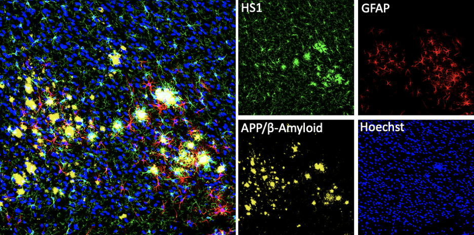 Strategies for Multiplex IF Using Conjugated Antibodies
