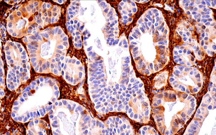 Mechanisms of Cell Death: Ferroptosis | CST Blog