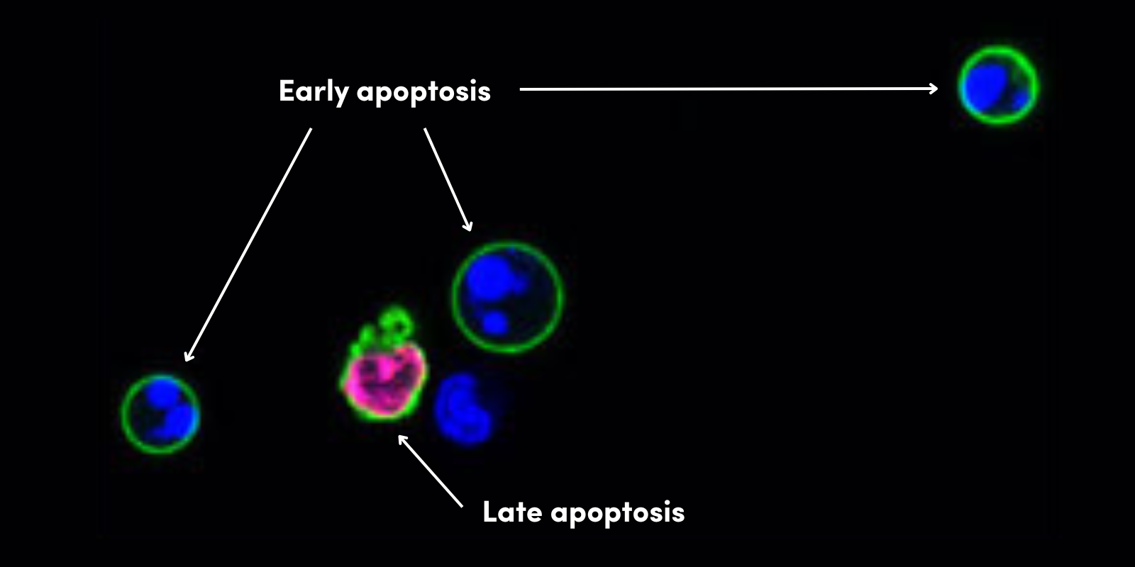 Mechanisms of Cell Death: Apoptosis | Intrinsic & Extrinsic Pathways