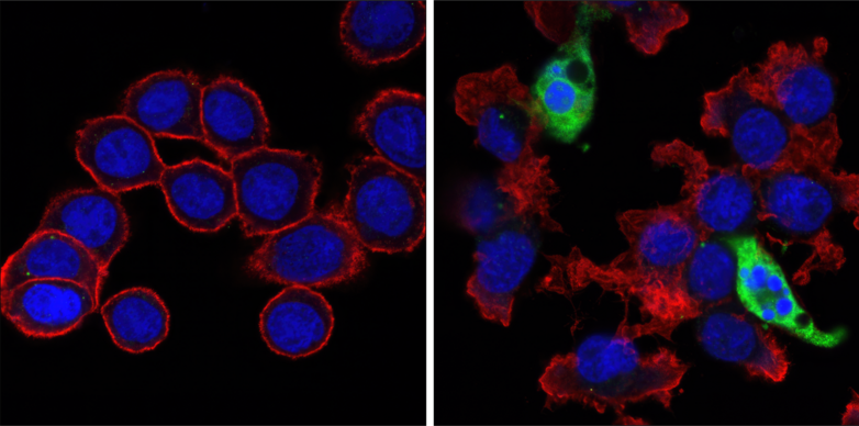 Apoptosis | Intrinsic & Extrinsic Pathways | Mechanisms of Cell Death