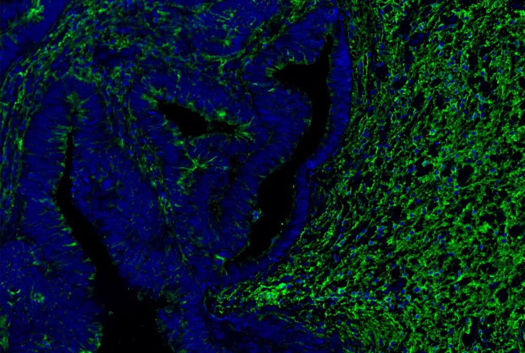Targeting the Tumor Microenvironment: Key ECM Markers | CST Blog