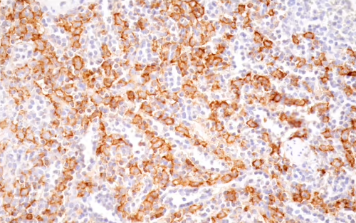 Immunophenotyping: Myeloid Cell Markers & Identification