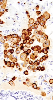 What are myeloid cells and how are they identified? | Immunology