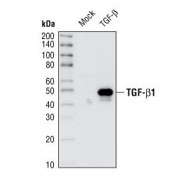 Astrocyte Markers for CNS Injury & Neurodegenerative Research