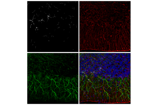 Multiplex Immunofluorescence with Chimeric Antibodies