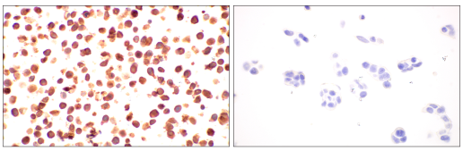 IHC-Validated p16 INK4A Antibody for Senescence and Cancer Research