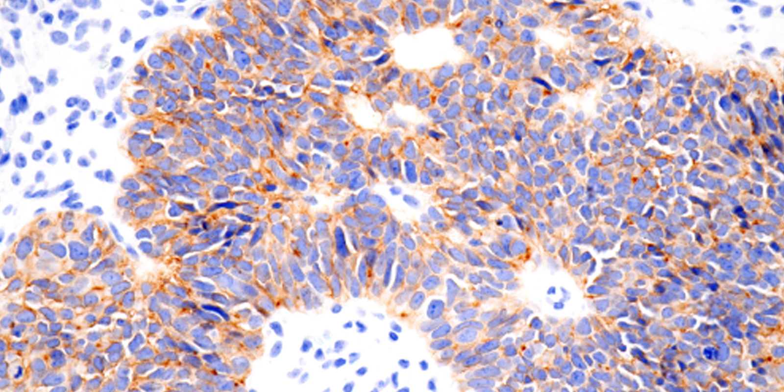 Application-Specific Validation: A Claudin-6 IHC Monoclonal Antibody