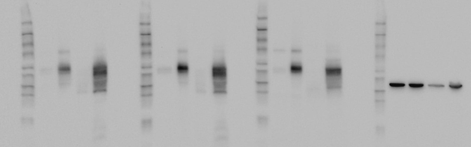 How to Choose a Loading Control for Western Blot