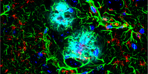 Guide to Neuronal & Glial Cell Markers | CST Blog