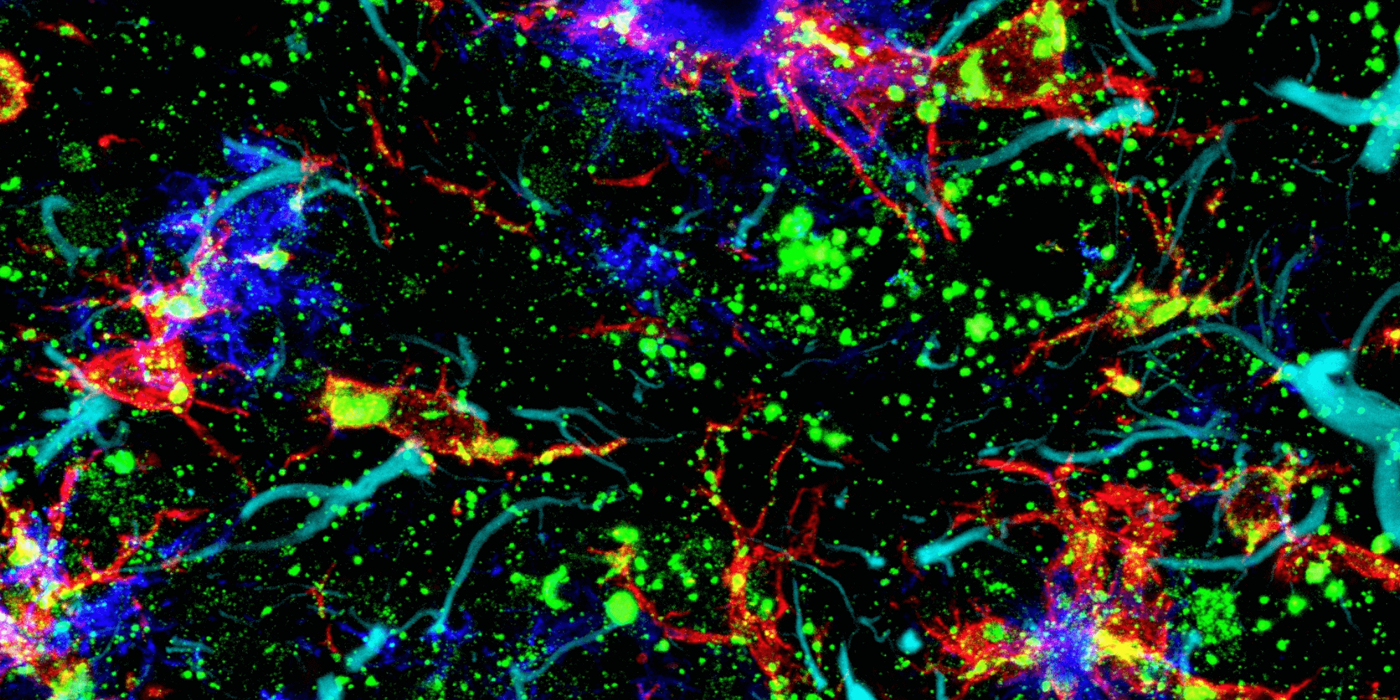 SfN 2022 年回顾：神经退行性疾病研究的新工具和新技术