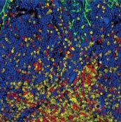 Webinar - Multiplex Immunohistochemistry (IHC)
