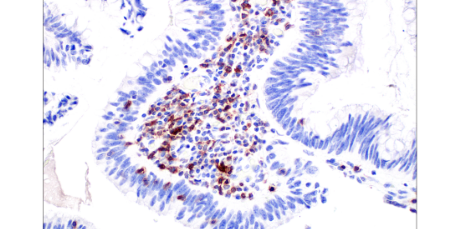 靶向 TIGIT 的免疫疗法和 T 细胞耗竭