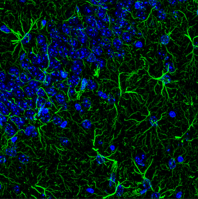 Multiplexing the Brain: A Galaxy of Possibilities | CST Blog