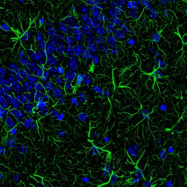 Multiplexing the Brain: A Galaxy of Possibilities | CST Blog